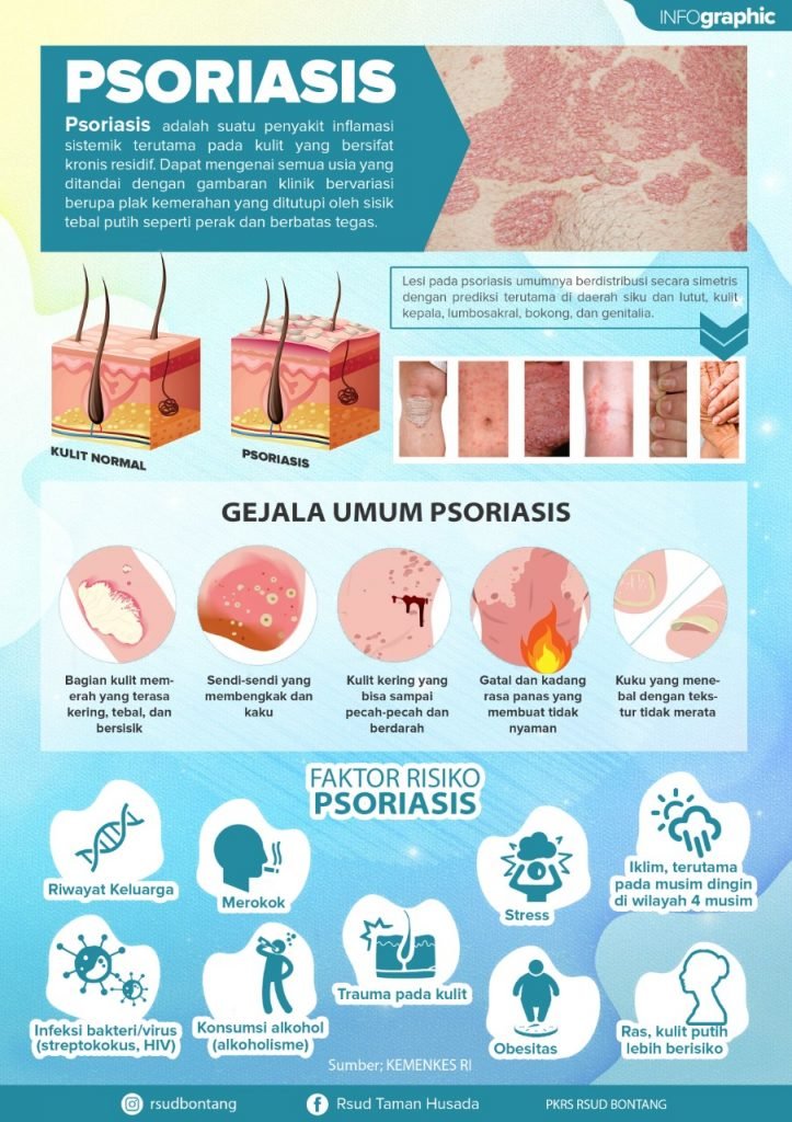 Mengenal Psoriasis Pengertian Gejala Dan Faktor Risikonya